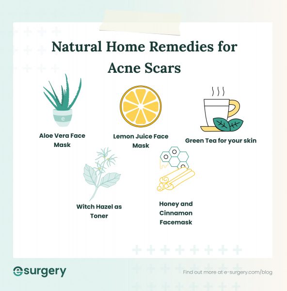 ᐅ 5 Natural + Easy Home Remedies For Acne Scars | E-Surgery