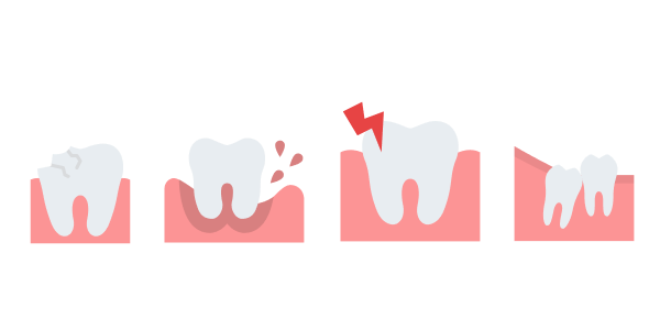 ᐅ Ultimate Guide: Dental Infection | E-Surgery
