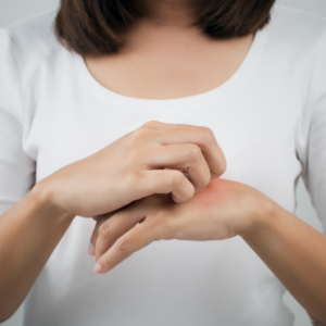 Ultimate Guide: Infected Insect Bites | E-Surgery